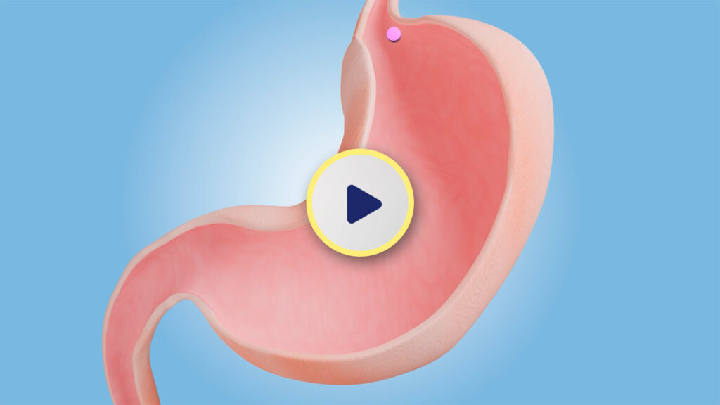 Ketodol | Analgesico e Antinfiammatorio con Gastroprotettore